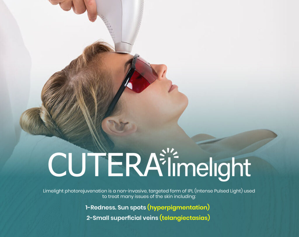 Cutera Limelight Laser – Yec Clinic